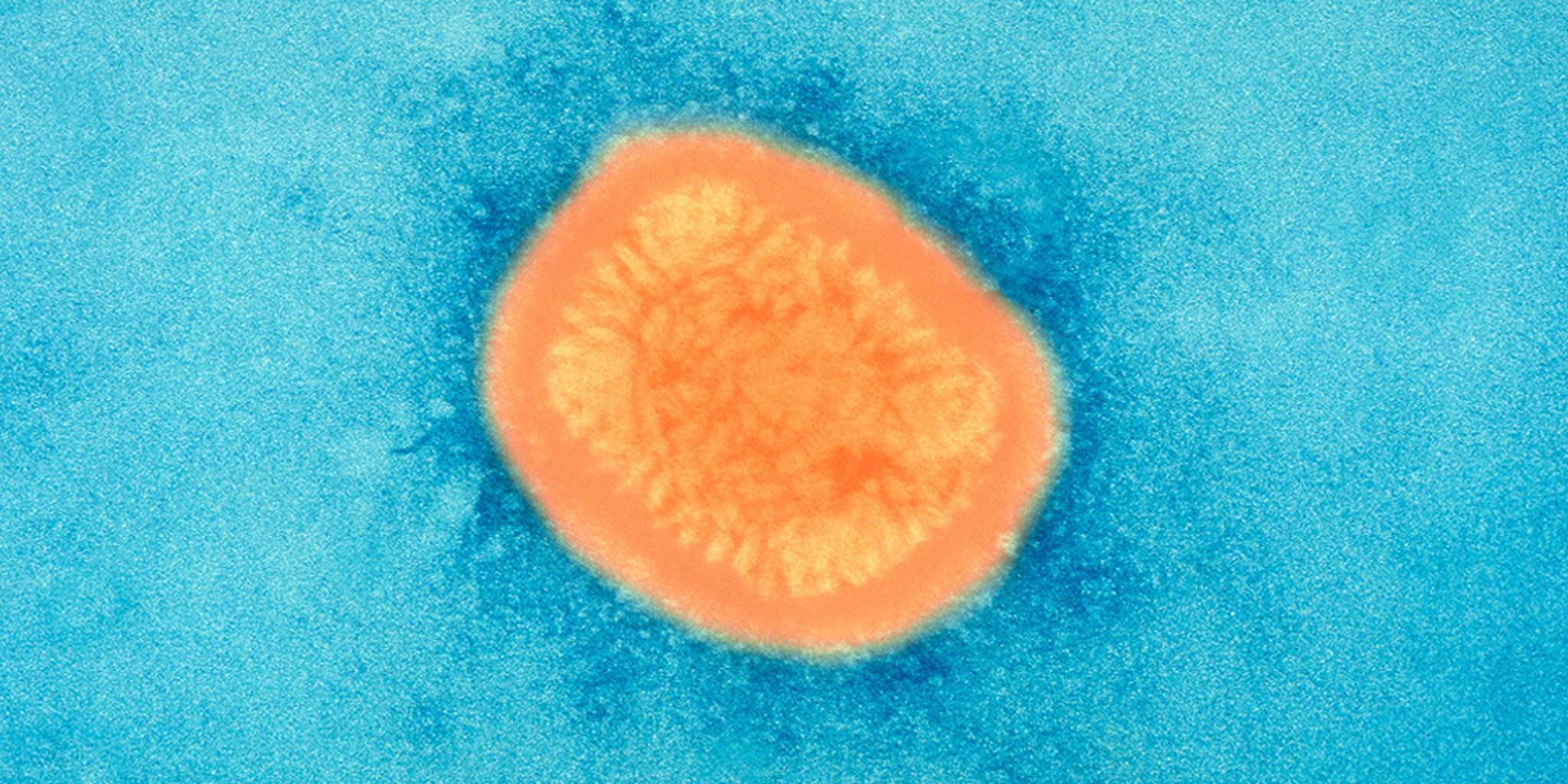 How the Internet changed the definition of 'viral'