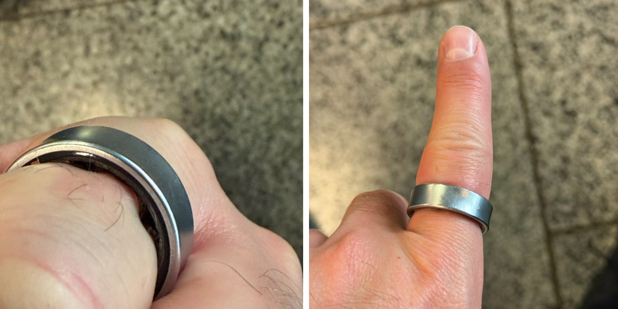 "New nightmare just dropped": Samsung Galaxy Ring swells on man's ...