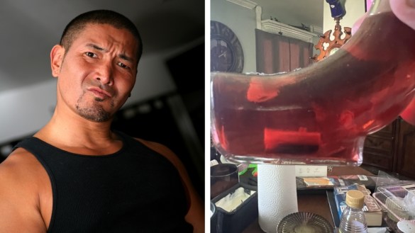 Whatever Is Growing in This Person's Red Wine Vinegar Looks Wrong — It ...