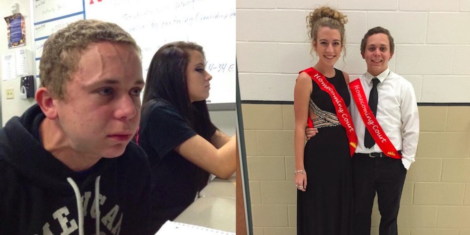Kid With Veins Meme: How A Teen's Forehead Vein Became a Meme
